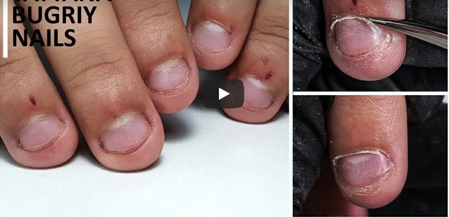 Σωστή εφαρμογή Dual Forms με Global Fashion (video) | Kris Nails